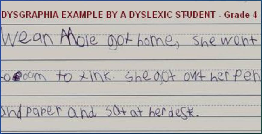 Disgrafi Nedir? Yazılı İfade Bozukluğunun Belirtileri Nelerdir? - Evrim ...