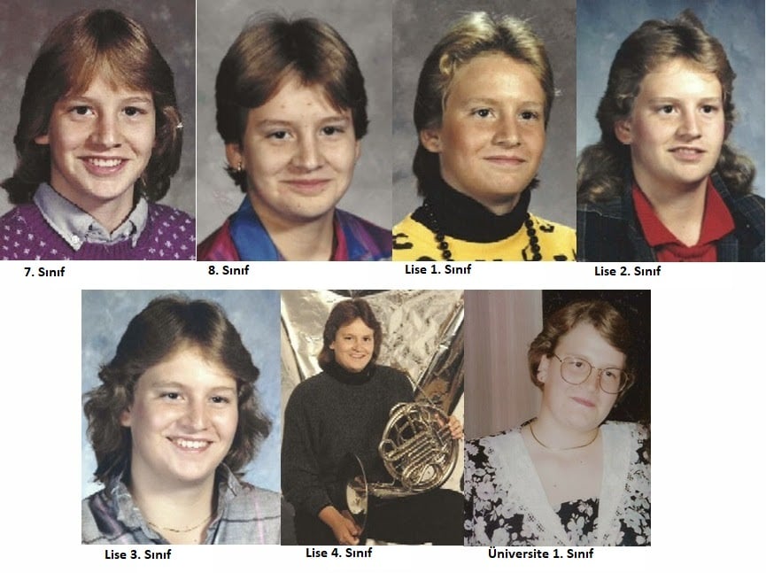 Swyer Sendromu: XY Kromozom Çifti Taşıyan Kadınlar! - Evrim Ağacı