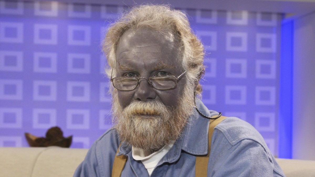 Arjiri: Aşırı Gümüş Tüketimi Sonucu Moraran İnsanlar! - Evrim Ağacı