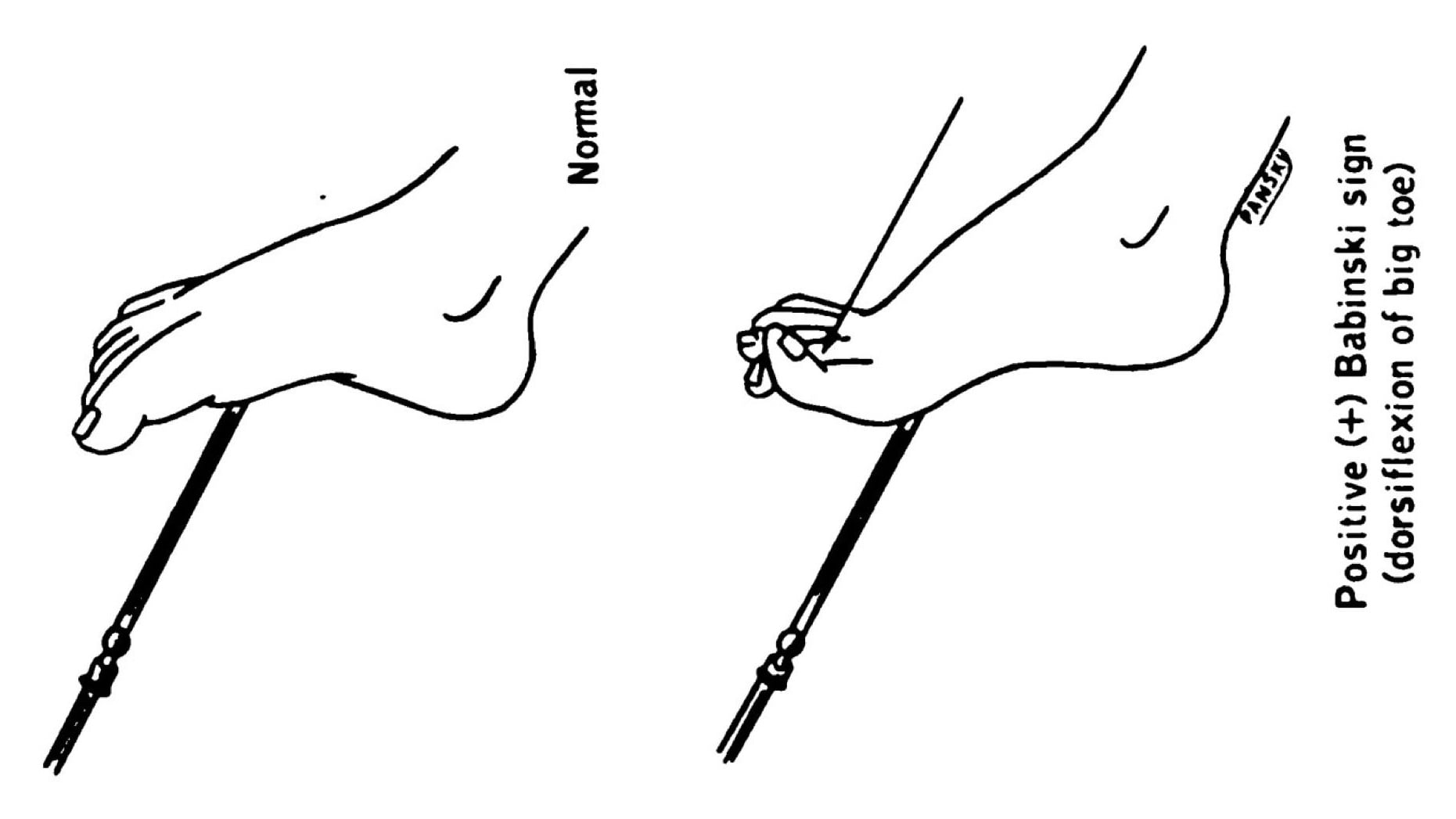 REFLEKS OLUŞUMU - Evrim Ağacı