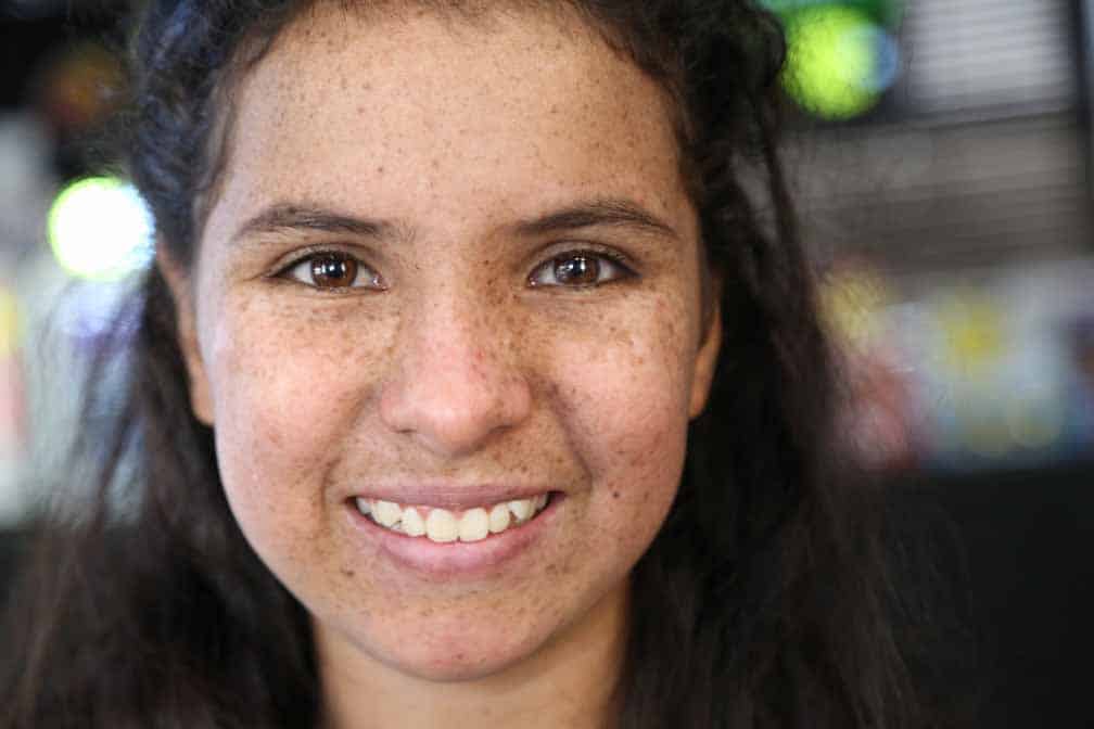 DNA Hasarı ve Onarımı: Hata Yapan DNA Parçaları Nasıl Tamir Edilir ...