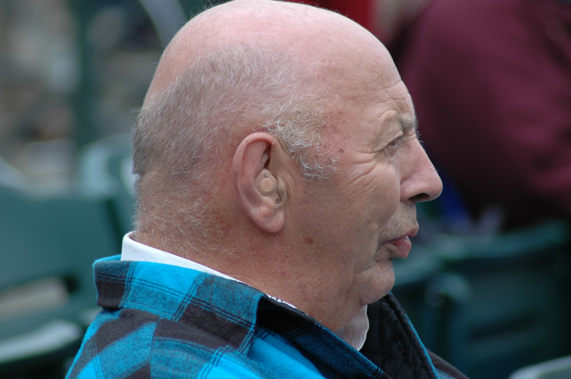 Kellik (Androjenik Alopesi) Nedir? Kel İnsanlar Evrimsel Süreçte Neden ...