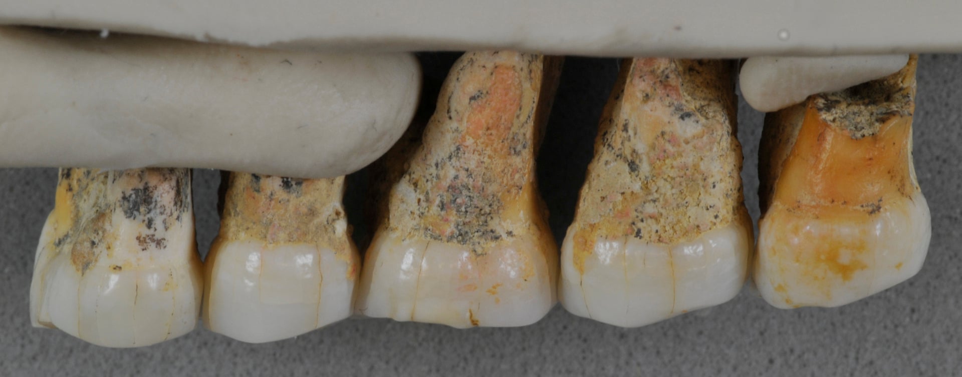 Homo luzonensis: Filipinler'de Keşfedilen Yeni İnsan Türü! - Evrim Ağacı